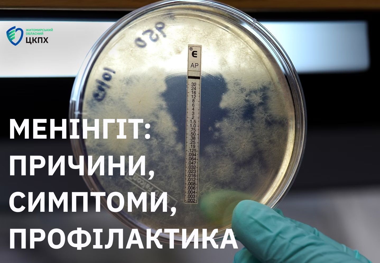 Менінгіт: причини, симптоми, профілактика - 20 хвилин Житомир